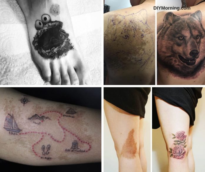 15 Creative Tattoo Ideas that Turn Birthmarks Into True Works of Art